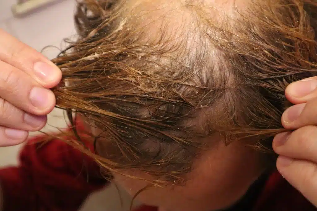How to Properly Wash Your Hair (for Men)